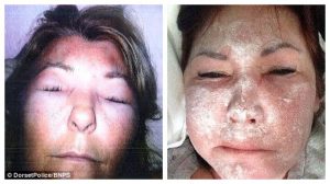 Disuntik Botox, Tiga Wanita Ini Sekarat Dan Menjadi Lebih Tua - REINHA.com